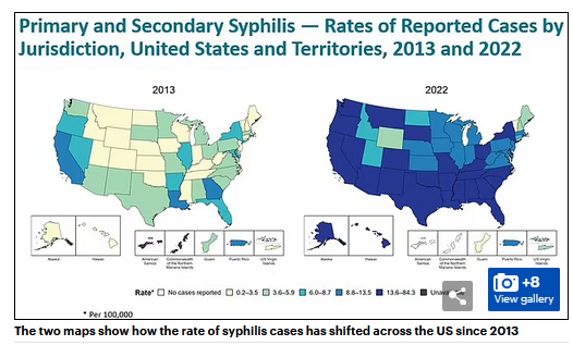 U.S. Syphilis Cases Surge to Highest Level in 70 Years