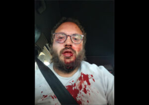 Aurora, CO, Apartment Worker Beaten Up by Venezuelan Gang